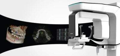 3D CBCT Dental Scan for Implants at HappyDental